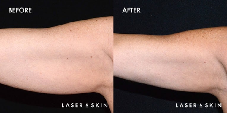 Laser & Skin Surgery Treatments Sacramento | Northern California