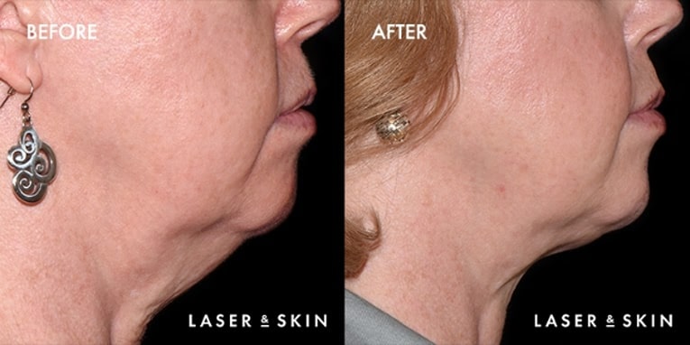 Laser & Skin Surgery Treatments Sacramento | Northern California