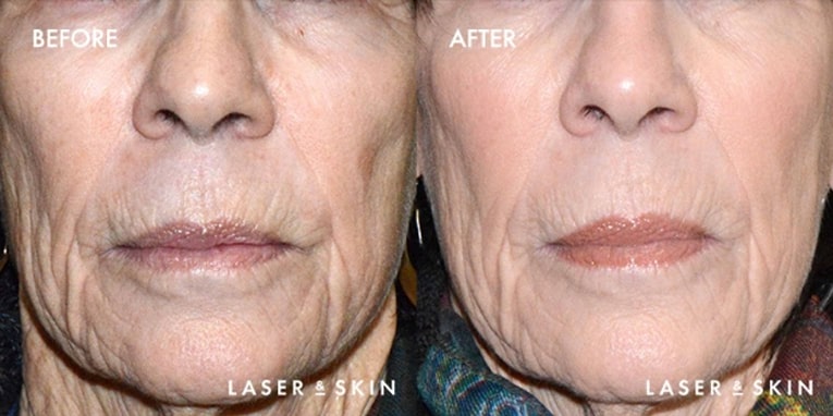 Laser & Skin Surgery Treatments Sacramento | Northern California