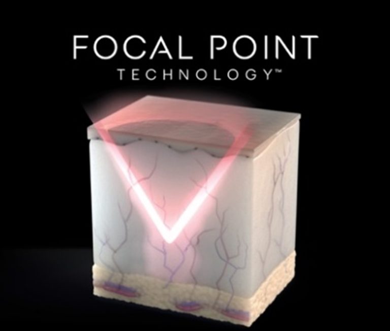 Avava - Laser & Skin Surgery Center of Northern California